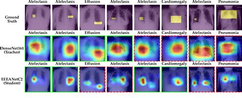 Explainable Knowledge Distillation For On Device Chest X Ray Classification