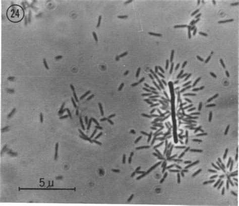 Biological Properties And Classification Of The Caulobacter Group