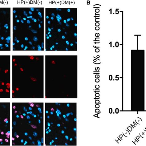 Immunofluorescence Analysis Showed That The Apoptosis Of Gastric