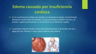 Regulación Del Volumen Y Composición Liquido Extracelular Pptx