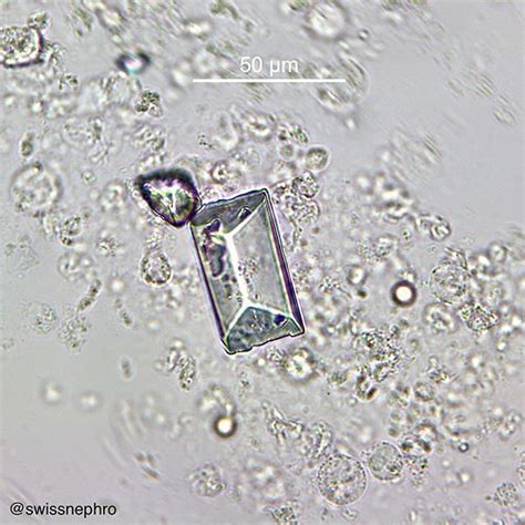 Magnesium Ammonium Phosphate Hexahydrate Crystal Triple Phosphate Or