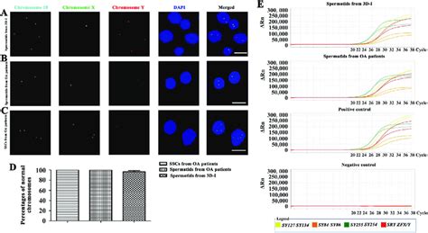 Chromosomes And Y Chromosome Microdeletion Analyses Of Human