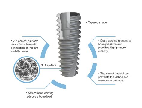 Conical Connection Sigma Implants Ltd