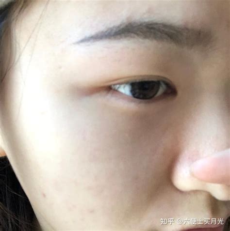 黑眼圈很重应该用什么眼霜 知乎