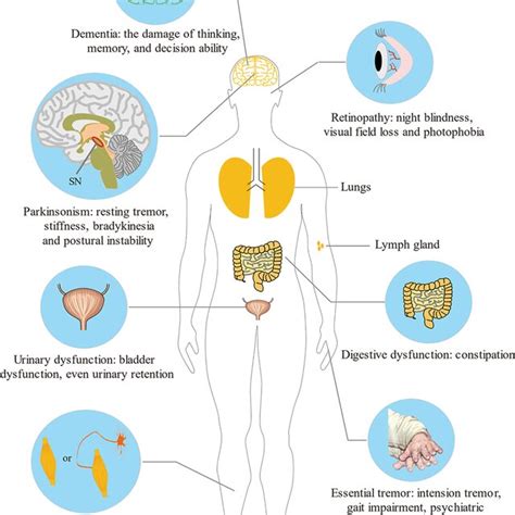 Phenotypes Of Notch2nlc Related Ggc Repeat Expansion Disorders The Download Scientific Diagram