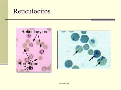 Unidad Ii Banco De Sangre