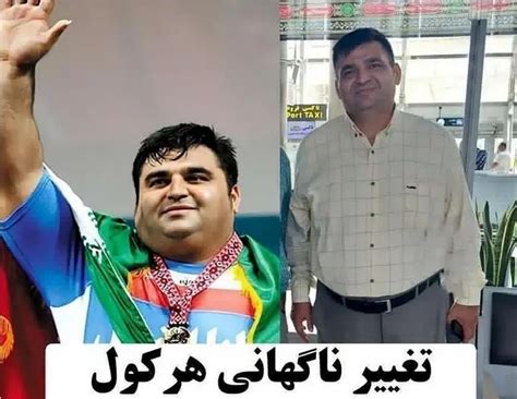 لاغری وحشتناک حسین رضازاده آیا او بیمار است ؟ عکس