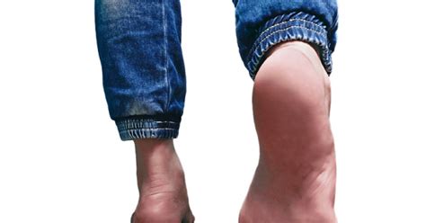 아침 첫발에 발뒤꿈치 찢어지는 통증…족저근막염 의심