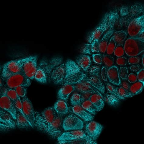 Cytokeratin 15 Esophageal Squamous Cell Carcinoma Marker Antibody
