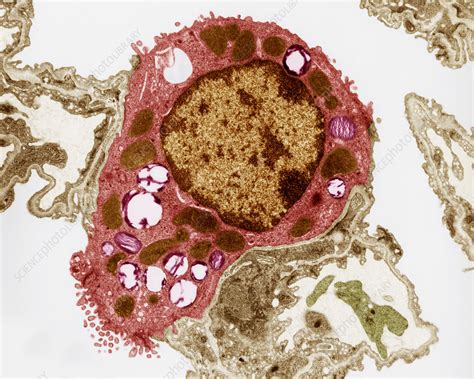 Alveolar Cell Tem Stock Image P5900273 Science Photo Library