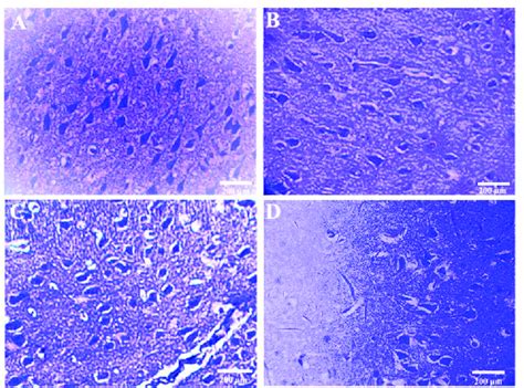 Nissl Staining For Frontal Cortex Cells In Four Groups In