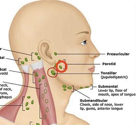 2 Swollen Lymph Nodes Tmj Related Or R Tmj