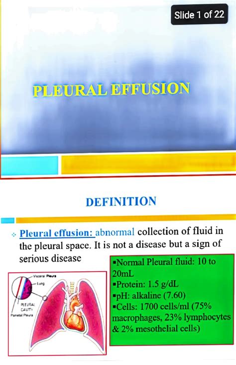 Pleural Effusion And Its Management Slide 1 Of Pleural Effusion Pleural Effusion And Its Management Slide 1 Of Pleural Effusion