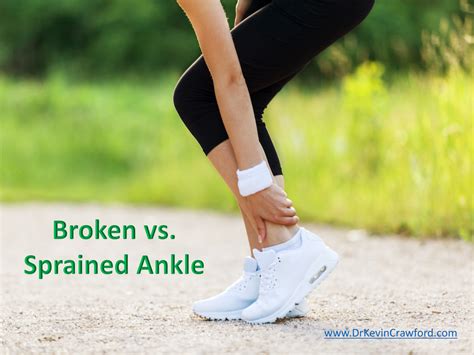 Sports Medicine Whats The Difference Between A Broken And Sprained Ankle