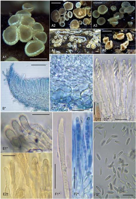 Studies In Hyaloscyphaceae Associated With Major Vegetation Types In