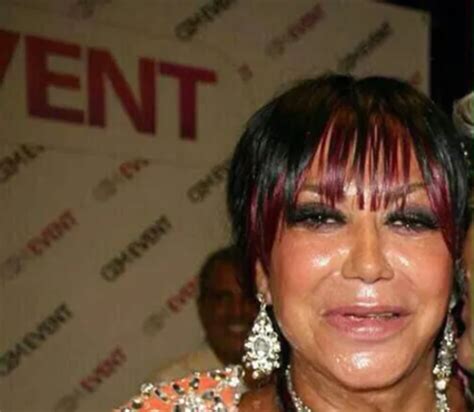 تغییرات شهره صولتی در ۶۵ سالگی عکس های قبل از عملش را دیده اید؟ روزنو