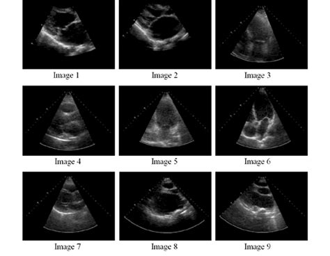 Processed Images By The Traditional Nonlinear Coefficient Diffusion