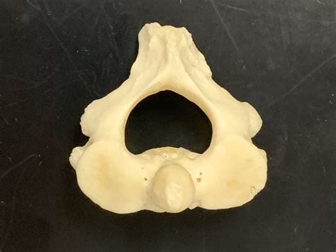 Cervical Vertebrae Axis C Diagram Quizlet