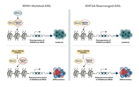 How Do Menin Kmt2a Inhibitors Work Acute Myeloid Leukemia Research