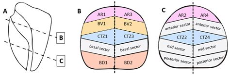 New Sector Map Of The Prostate A Sagittal Section Of The Prostate With