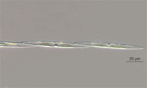 Nitzschia Pungens Marine Biodiversity Portal Of Bangladesh