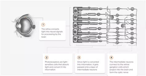 Neuralink Co Founders New Rival Company Requires No Hole Drilling In