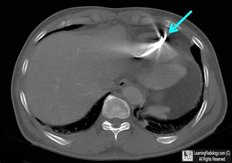 Learningradiology