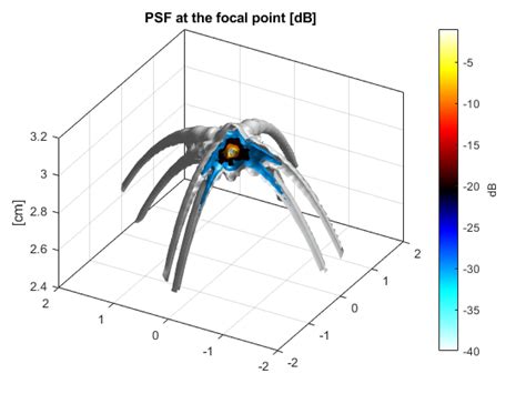 SIMUS3 Simulation Of Ultrasound RF Signals For A Planar 2 D Array
