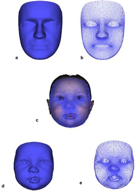 Assessment Of Facial Asymmetry Before And After The Surgical Repair Of