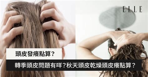 轉季頭皮護理！頭皮發癢點算？4個舒緩頭皮痕癢頭皮濕疹方法 Elle Hk