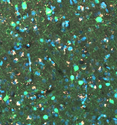 Using Qupath For Rnascope Ihc Colocalization Image Analysis Imagesc Forum