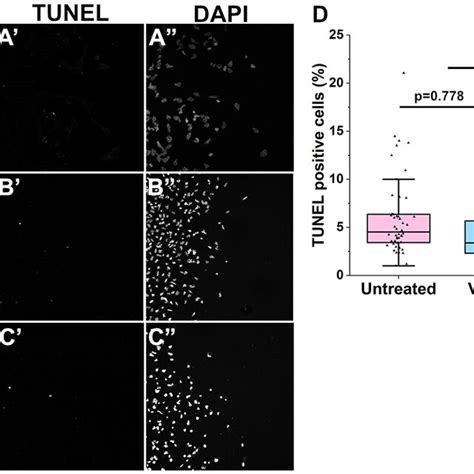 Fig S3 Nex20 Treatment Does Not Cause Cell Death In Cranial Neural