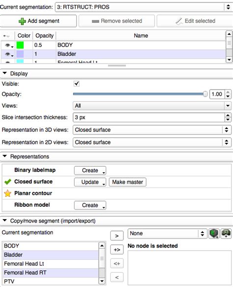 Documentation 4 5 Modules Segmentations Slicer Wiki