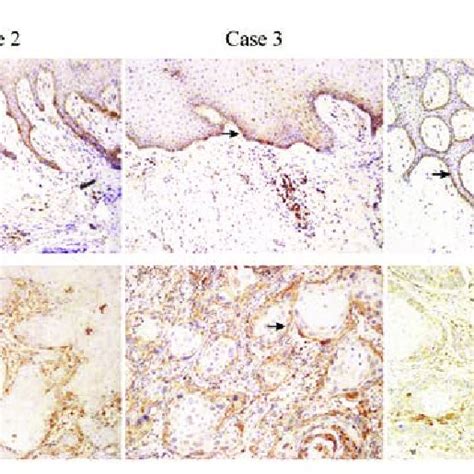 Expression Of Fth And Ftl In Human Primary Cells Isolated From