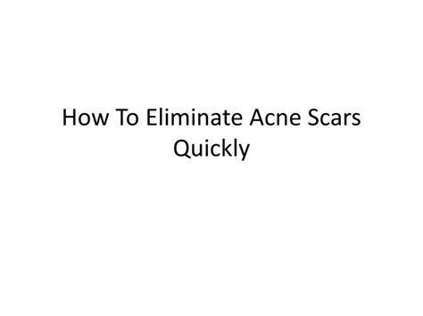 PPT How To Eliminate Acne Scars Quickly PowerPoint Presentation Free Download ID