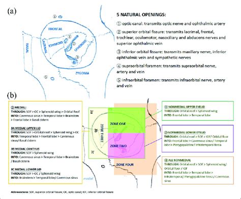 A Anatomy Of The Orbit B Common Pattern Of Injury According To The
