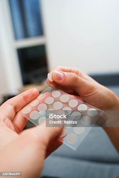 손의 클로즈업은 피부 치료를 위해 여드름 패치를 잡습니다 여드름과 주사 피부를 위한 화장용 여드름 패치 건강관리와 의술에 대한 스톡 사진 및 기타 이미지 Istock