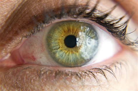 Green Eye With Heterochromia Central Heterochromia Pinterest