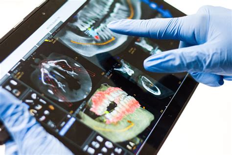 What Is A Dental CBCT Scan And Why Do You Need One