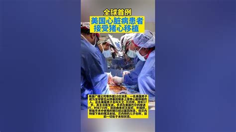 全球首例美國心臟病患者接受豬心移植 Youtube