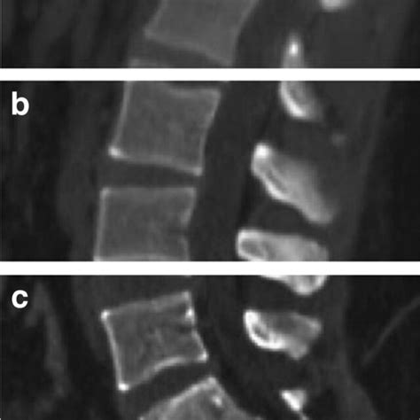 Basic Comparison Of Energy Integrated Detector Eid A And