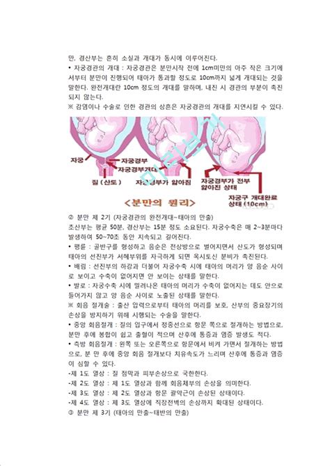 Normal Spontaneous Vaginal Delivery Casestudy