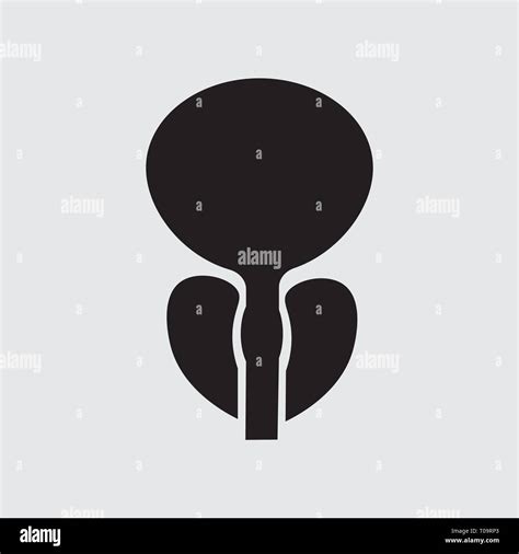 Normal Prostate And Acute Prostatitis Medical Illustration Icon 10 Eps