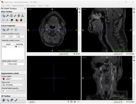 Is Better To Use `itk Imread Dir ` Than `itk Imread File List ` Beginner Questions Itk