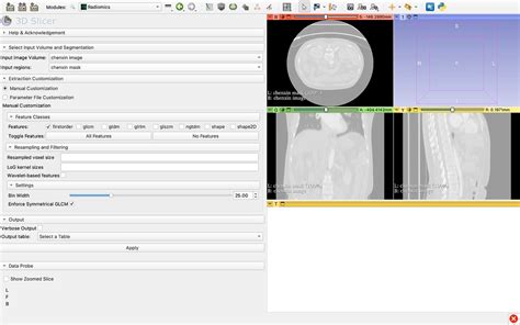 影像文件和roi文件同时导入到3d Slicer后，不显示roi区域。 问题求助 3dslicer中文论坛