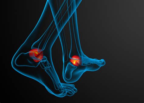 C Thomas Haytmanek Md And Jonathon Backus Md Sports Foot And Ankle