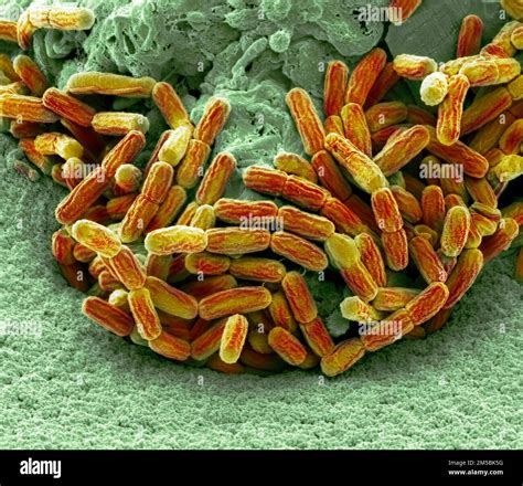 Bacteria From Stagnant Water Coloured Scanning Electron Micrograph