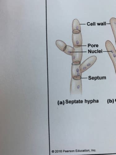 Ch 12 The Eukaryotes Fungi Algae Protozoa And Helminths Flashcards Quizlet