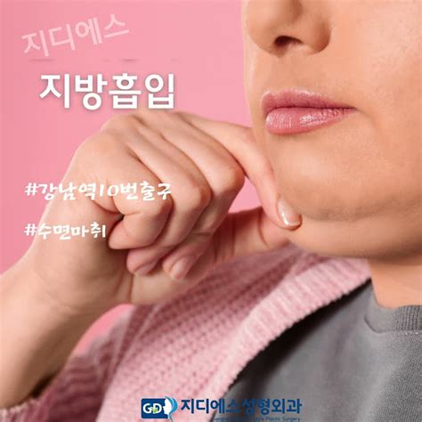 이중턱지방흡입은 지디에스성형외과 지디에스 Youtube