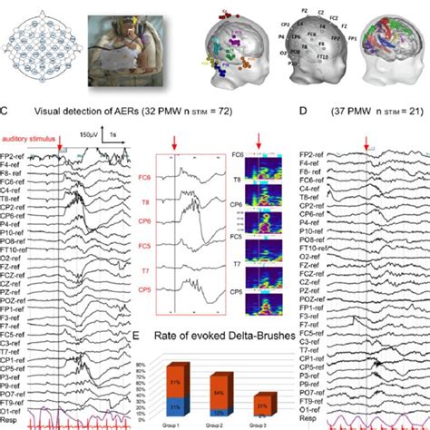 EEG Recording Localization Of The Electrodes Position And Visual Download Scientific Diagram